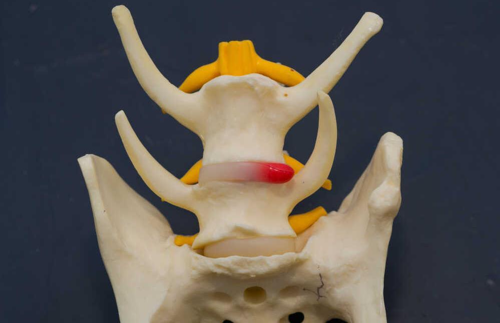 ¿Cubre el seguro la rotura del ligamento en perros? | Caser